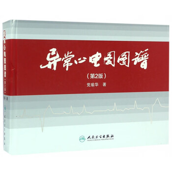 异常心电图图谱(第2版)(精)