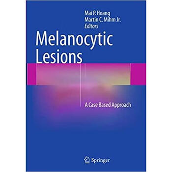 高被引Melanocytic Lesions: A Case Based Approach