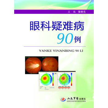眼科疑难病90例【正版图书】