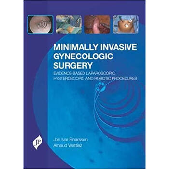 Minimally Invasive Gynecologic Surgery: Evidence