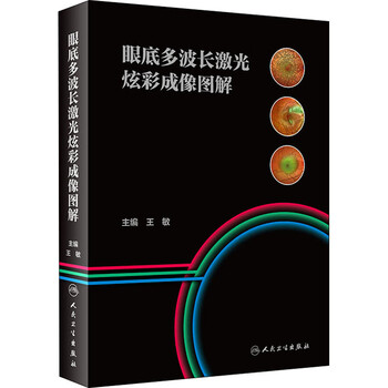 眼底多波长激光炫彩成像图解