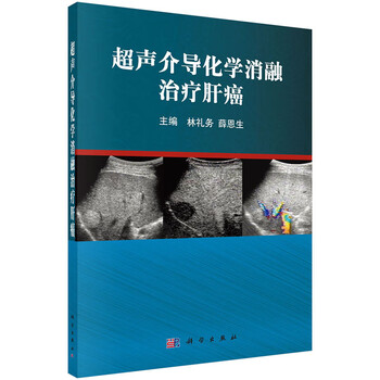 超声介导化学消融治疗肝癌