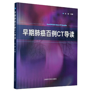 早期肺癌百例CT导读(精)