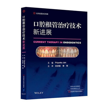 口腔根管治疗技术新进展
