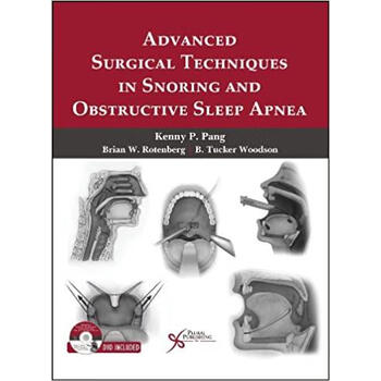 Advanced Surgical Techniques in Snoring and Obst