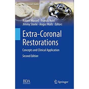 Extra-Coronal Restorations: Concepts and Clinica