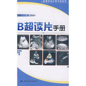 B超读片手册——影像学读片掌中宝系列