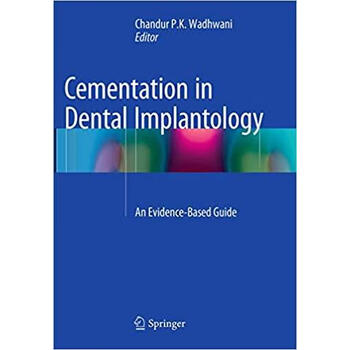 Cementation in Dental Implantology: An Evidence-
