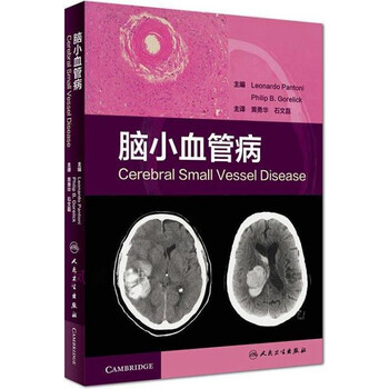 脑小血管病 黄勇华，石文磊著 人民卫生出版社