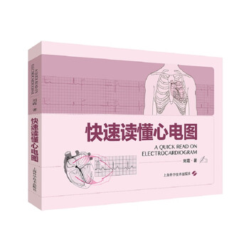 快速读懂心电图