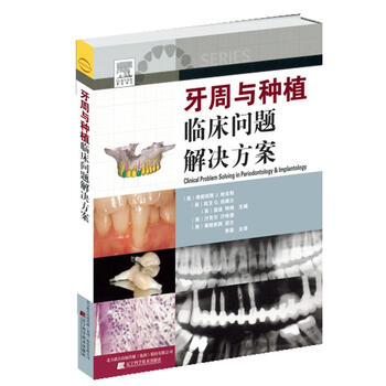 牙周与种植临床问题解决方案 弗朗西斯 J 哈吉斯,凯文 G 西摩尔,温 辽宁科学技术出版社