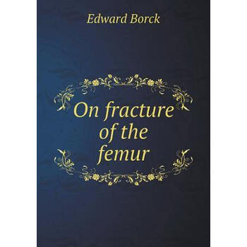 On Fracture of the Femur