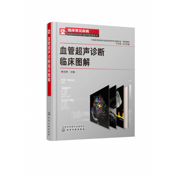 血管超声诊断临床图解(精)/临床常见疾病超声图谱系列