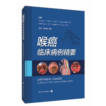 [正版图书]喉癌：临床病例精要