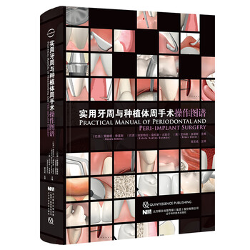 实用牙周与种植体周手术操作图谱