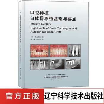 口腔种植自体骨移植基础与要点 医学书籍