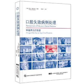 口腔失败病例处理(种植再治疗图谱)(精)