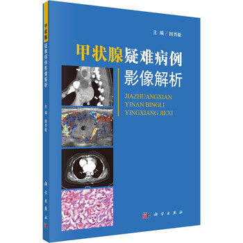 甲状腺疑难病例影像解析 图书