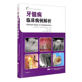 [正版图书]牙髓病临床病例解析