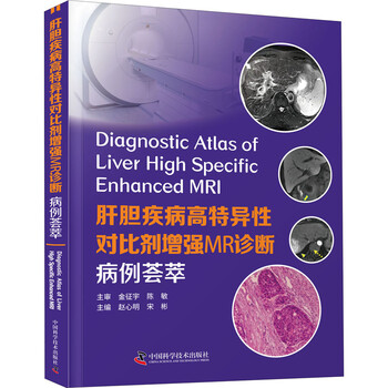 肝胆疾病高特异性对比剂增强MR诊断 病例荟萃