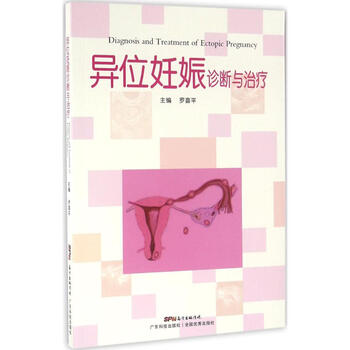 异位妊娠诊断与治疗 罗喜平 主编 书籍