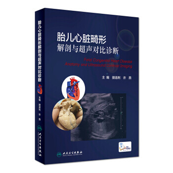 胎儿畸形解剖与超声【正版图书】
