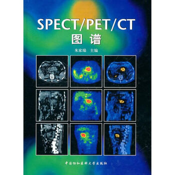 SPECT/PET/CT图谱 朱家瑞 作 书籍