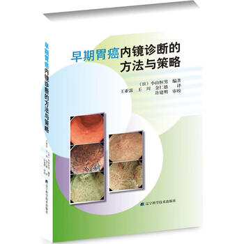 早期胃癌内镜诊断的方法与策略 (日)小山恒男 编;王亚雷,王川,金仁德 译  书籍