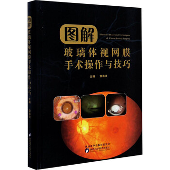 图解玻璃体视网膜手术操作与技巧