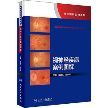 视神经疾病案例图解 编者:田国红//孙兴怀  田国红,孙兴怀 编 书籍