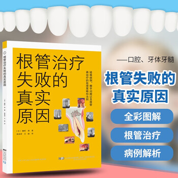 根管治疗失败的真实原因 日鶴町保著侯本祥王皓译 口腔修复正畸种植学医学类专业书籍图谱牙体牙髓病真正根尖周病变辽宁科技出版社