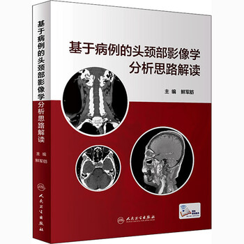 基于病例的头颈部影像学分析思路解读 图书