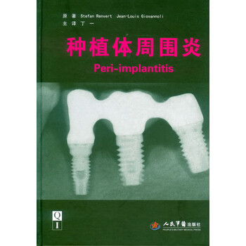 种植体周围炎