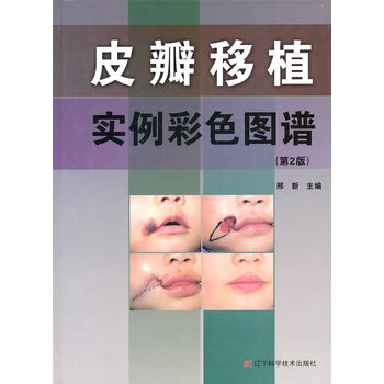 皮瓣移植实例彩色图谱(第2版)【正版图书】