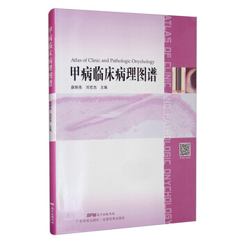  甲病临床病理图谱9787535970954