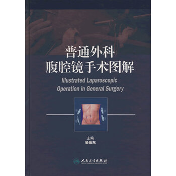 普通外科腹腔镜手术图解 吴硕东 9787117103305 人民卫生出版社