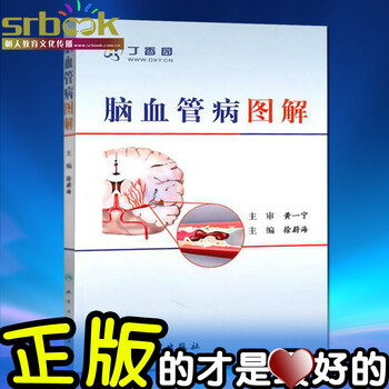 正版 脑血管病图解 徐蔚海 脑血管病基础知识 脑血管病图谱 神经介入技术医学工具书籍
