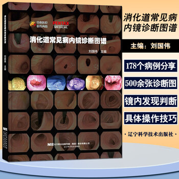 消化道常见病内镜诊断图谱 刘国伟 消化系统疾病诊断图片案例分析 消化道内窥镜检图谱 内科医师