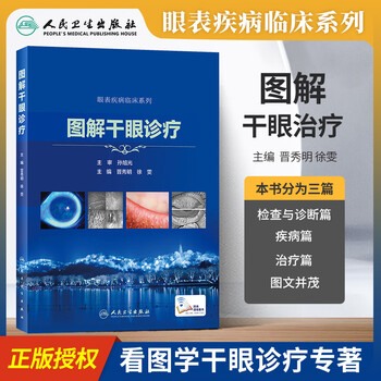 图解干眼诊疗 晋秀明徐雯主编 2020年10月参考书 人卫出版社