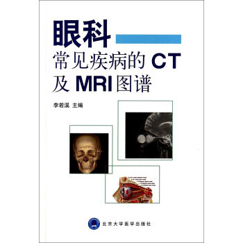 眼科常见疾病的CT及MRI图谱【正版图书】