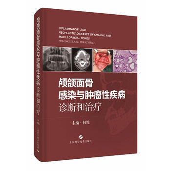 颅颌面骨感染与肿瘤性疾病：诊断和治疗