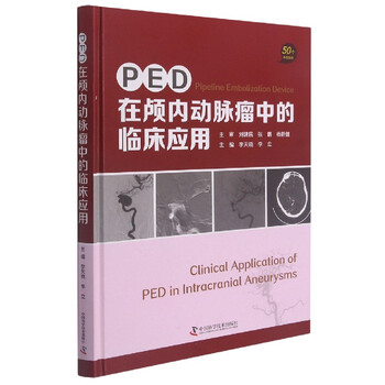 PED在颅内动脉瘤中的临床应用(精)