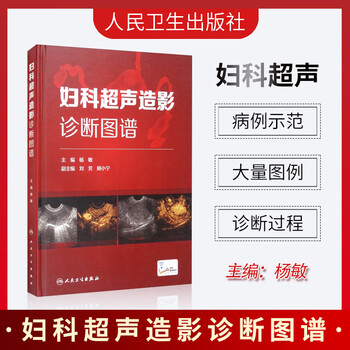 妇科超声造影诊断图谱 人民卫生出版社