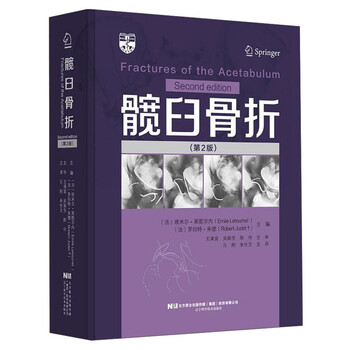 髋臼骨折