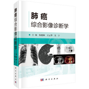 肺癌综合影像诊断学 9787030609618