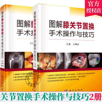 全2册图解髋关节置换手术操作与技巧+图解膝关节置换手术操作与技巧 髋关节置换基础理论书骨科医师关节外科临床骨科手术Y