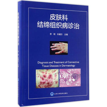 皮肤科结缔组织病诊治