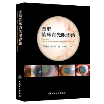 图解临床青光眼诊治