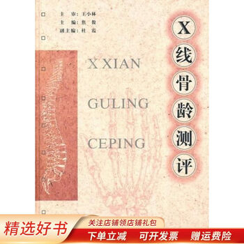 X线骨龄测评