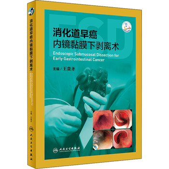 消化道早癌内镜黏膜下剥离术 图书